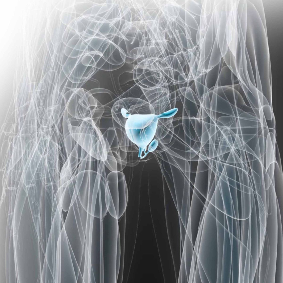Radiotherapy for prostate cancer | Elekta