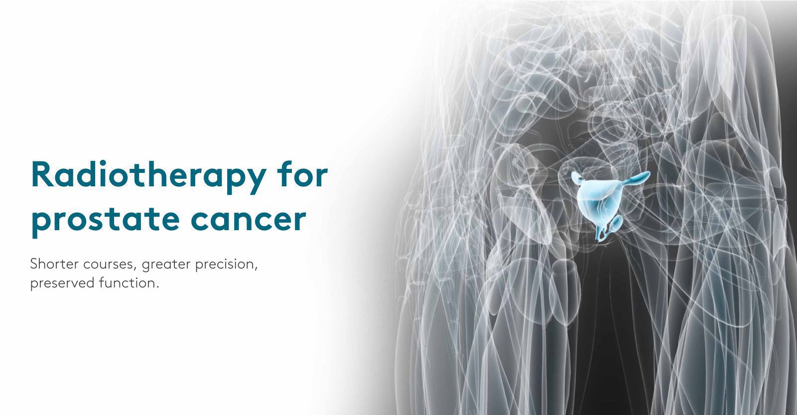 Radiotherapy for prostate cancer | Elekta