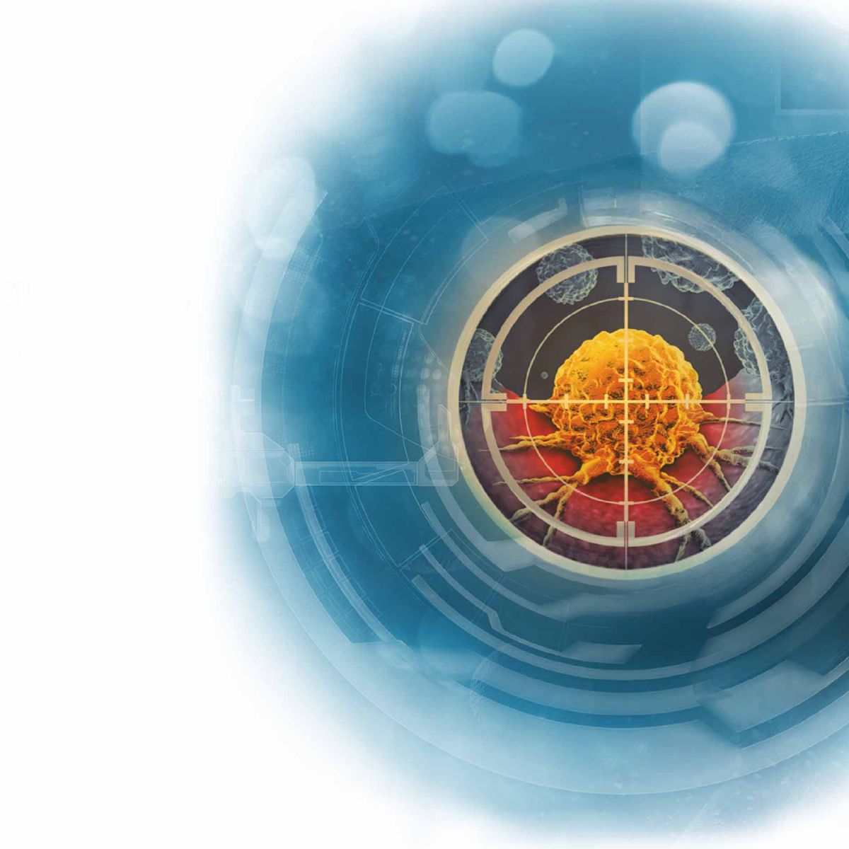 Elekta | Radiotherapy Treatment Solutions | Cancer Care