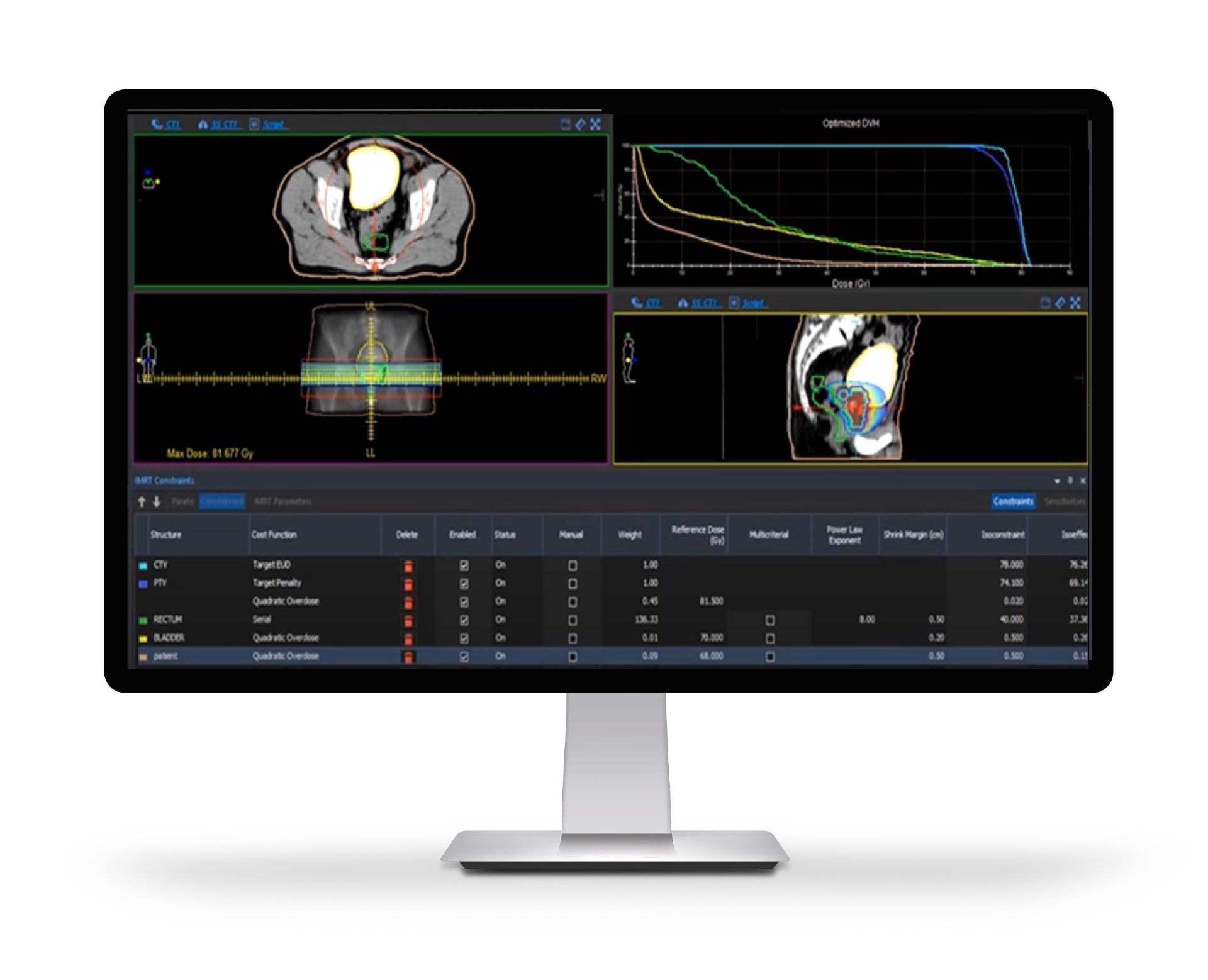 Elekta ONE Planning | Oncology Software | Elekta