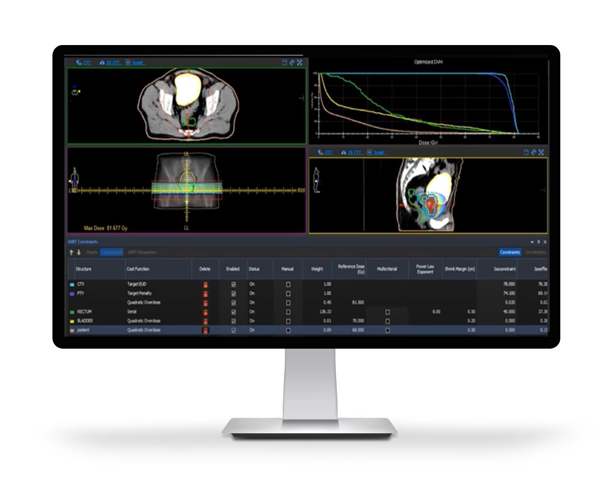 Elekta ONE Planning | Oncology Software | Elekta