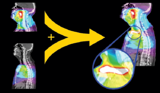 Elekta ONE Planning | Oncology Software | Elekta